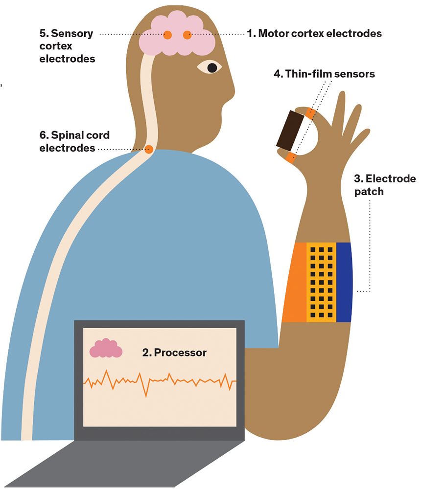 IEEE Spectrum NA February 2021Bypassing Paralysis