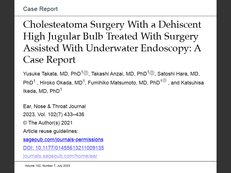 ENT - July 2023Cholesteatoma surgery with a dehiscent high jugular bulb ...