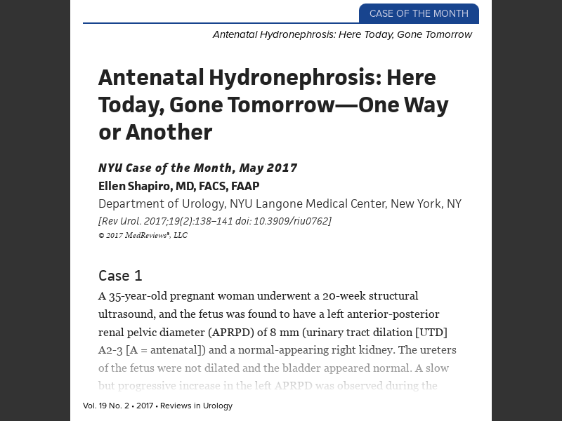 Reviews in Urology Volume 19, No. 2 2017Antenatal Hydronephrosis: Here ...