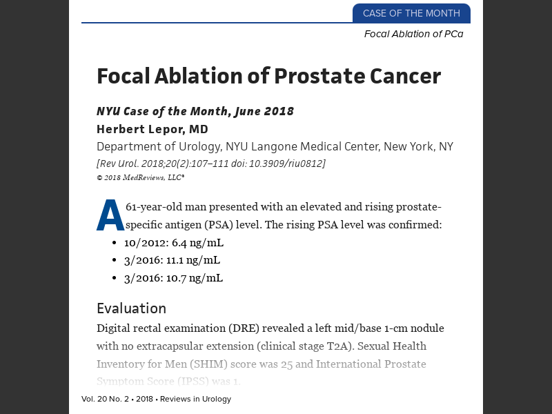 Reviews in Urology Volume 20, No.2 2018Focal Ablation of Prostate Cancer